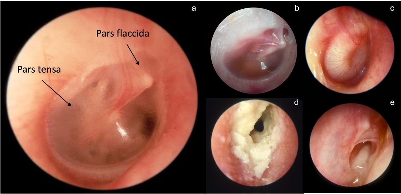 How to perform otoscopy | ADC Education & Practice Edition